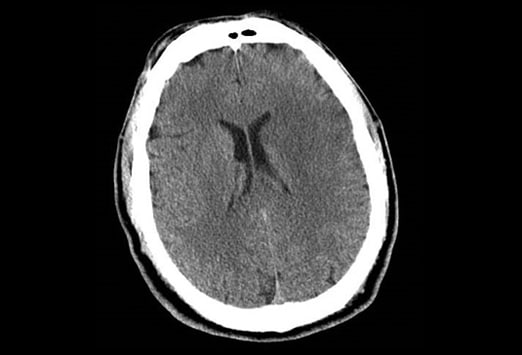 Diaporama : le scanner cérébral sans injection | Medscape