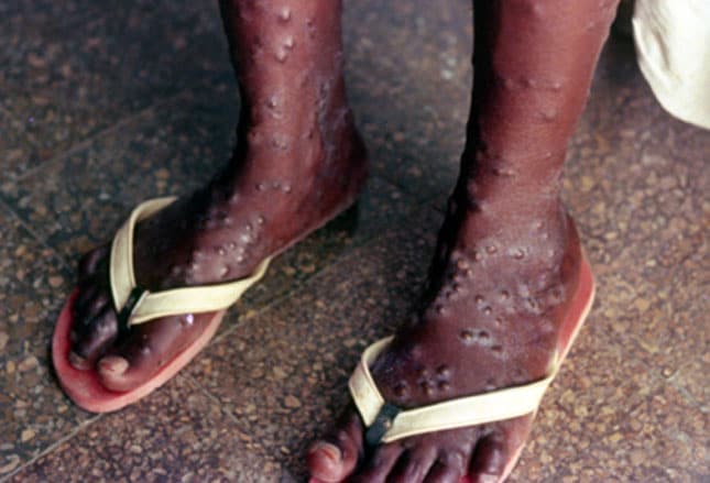 Manifestations cutanées des empoisonnements : 10 cas cliniques