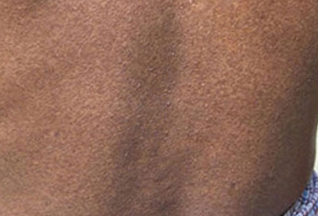 Manifestations cutanées des empoisonnements : 10 cas cliniques