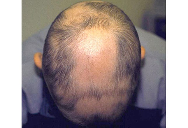 Manifestations cutanées des empoisonnements : 10 cas cliniques