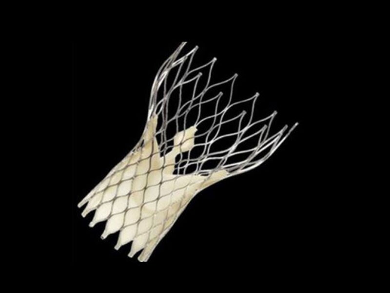 TAVI : CoreValve à 2 ans