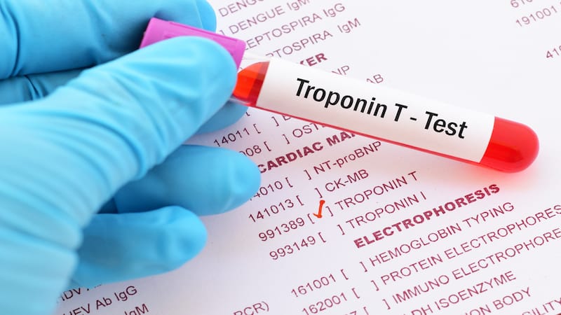 L’utilisation de la troponine haute sensibilité est liée à de meilleurs ...
