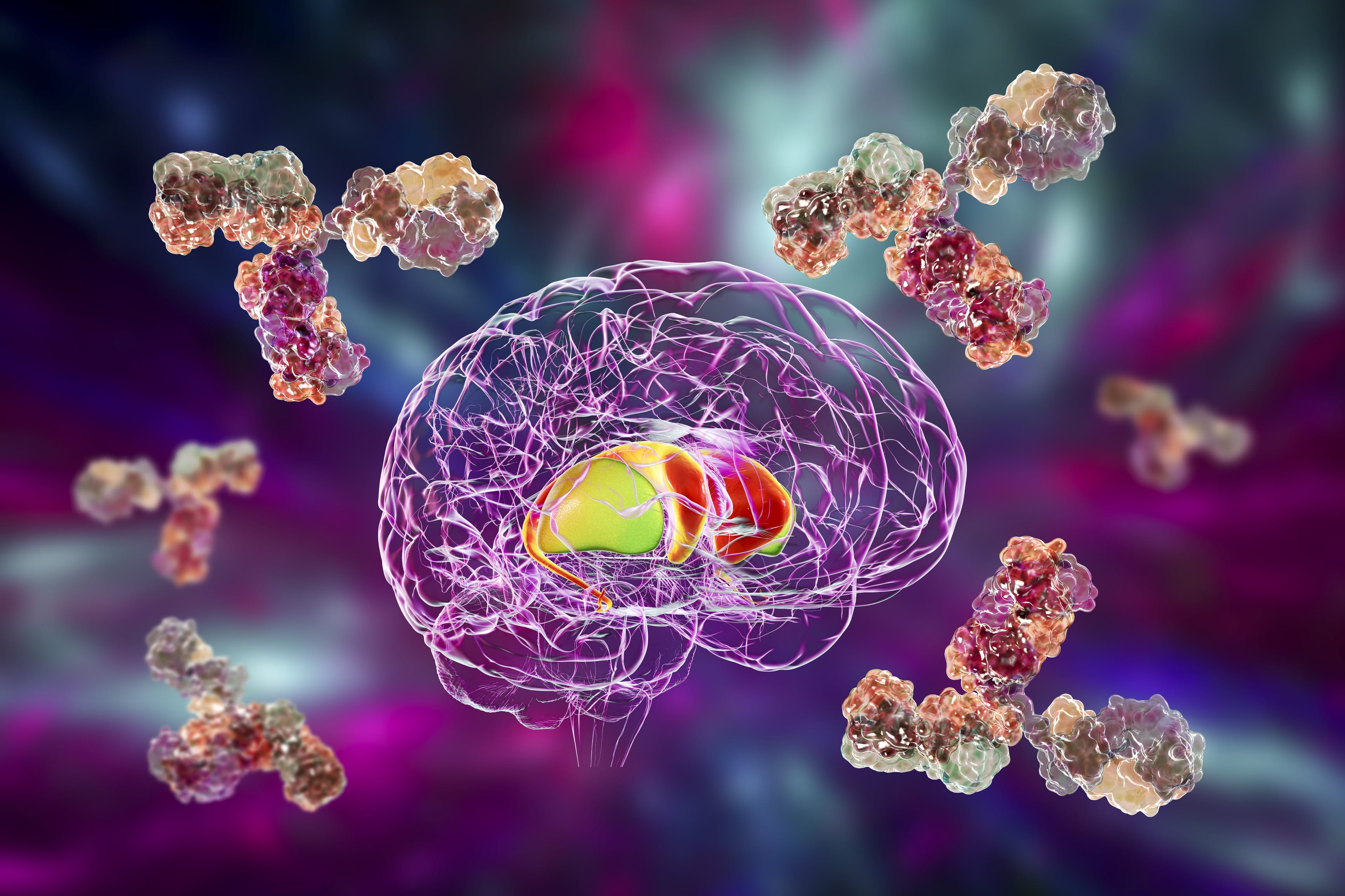 Alzheimer Les Anticorps Anti amylo des Ont ils Un Futur