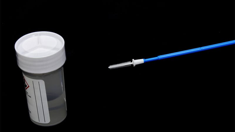 Cancer du col : les autotests HPV pourraient doubler la participation ...