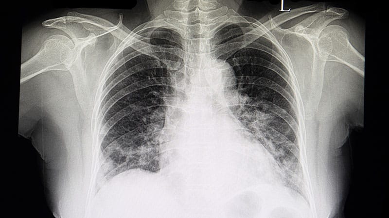 Cardiologie - theheart.org | Medscape
