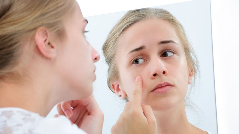 Dysmorphophobie : la connaitre et la repérer chez vos patients