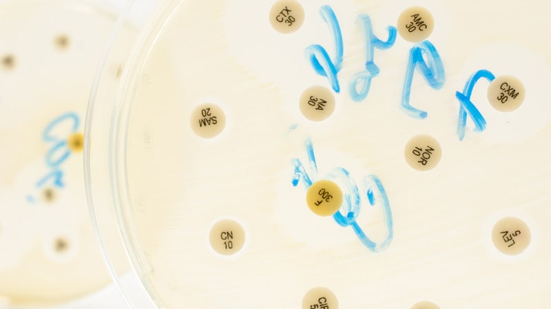 Antibiogramme : savoir décrypter le rendu des résultats