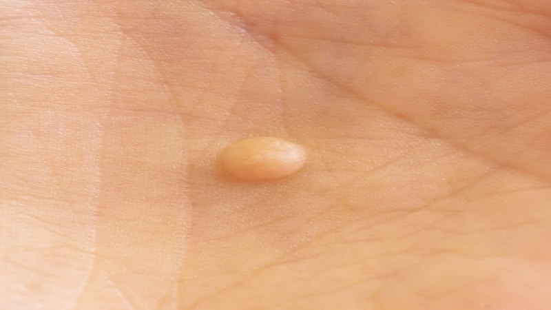 Pédiatrie - Medscape