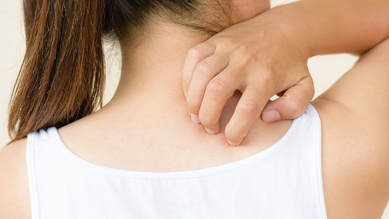 Teigne de l’enfant : la griséofulvine est indisponible, quelles ...