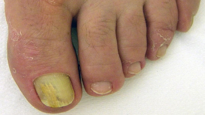 Hémato/Oncologie - Medscape