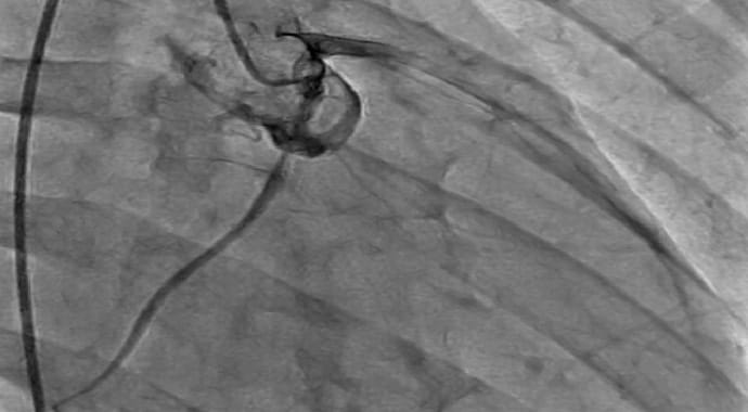 Cas clinique : arrêt cardio-respiratoire pendant un match de foot - Page 2
