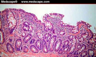 A Mosaic Pattern of the Descending Duodenum - Page 2