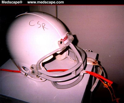 Bleeding From Gastric Varices - Page 3