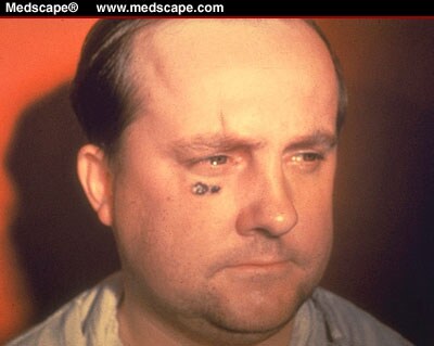 Expert Column - Can Derm Warfare Fight Germ Warfare? - Page 3