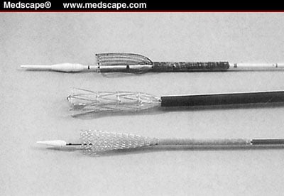 Applications for Expandable Metal Stents - Page 2
