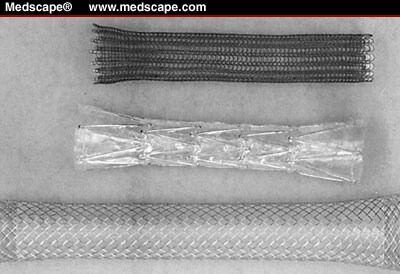 Applications for Expandable Metal Stents - Page 2