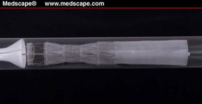 Applications for Expandable Metal Stents - Page 3