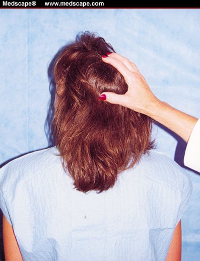 The Evaluation of Patients With Neck Pain - Page 4