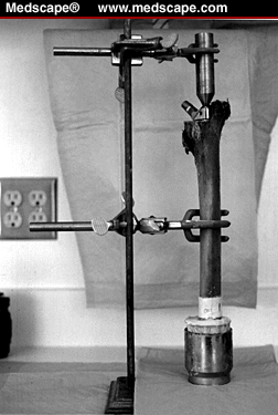 Cementless S-ROM Femoral Component - Page 2