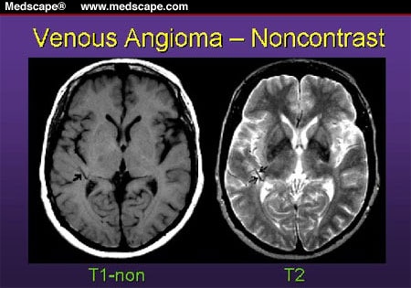 Caput Medusa - Page 5
