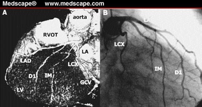 Three-Dimensional Coronary Anatomy - Page 2