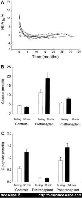 Successful Islet Transplantation - Page 3