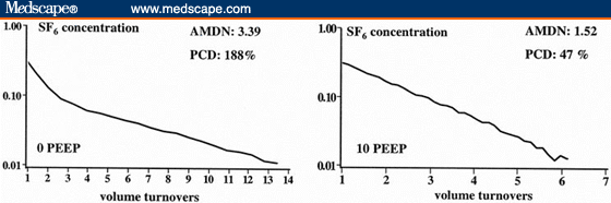 Positive End-Expiratory Pressure and Ventilation Inhomogeneity - Page 3