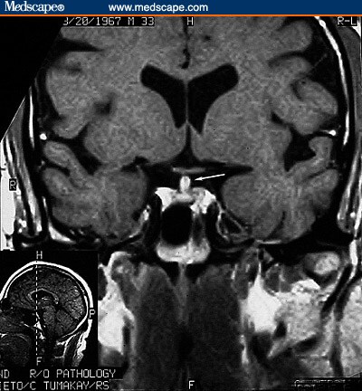 Man With Polyuria and Polydipsia - Page 2