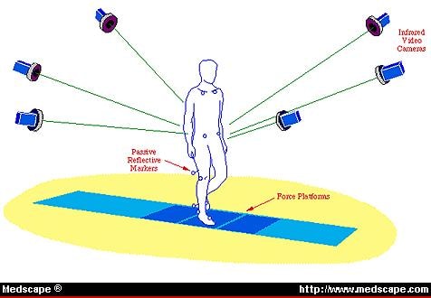 Clinical Gait Analysis and Its Role in Treatment Decision-Making - Page 2
