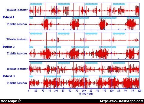 Clinical Gait Analysis and Its Role in Treatment Decision-Making - Page 7