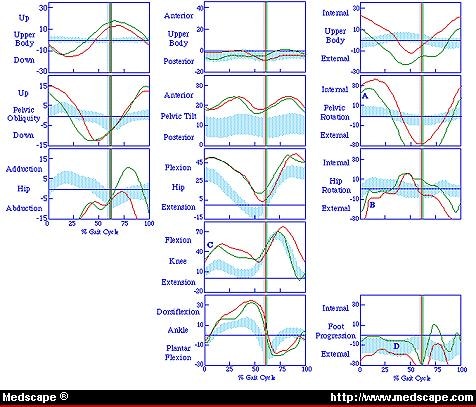 Clinical Gait Analysis and Its Role in Treatment Decision-Making - Page 8