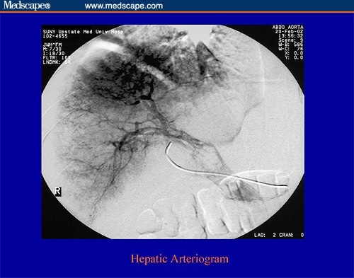 Interventional Perspectives: Case I