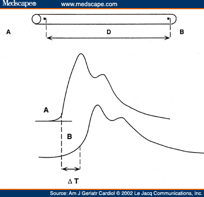 Aortic Pulse Wave Velocity - Page 3