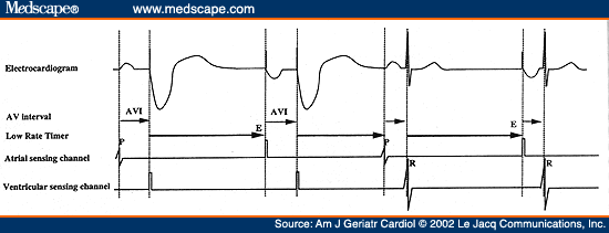Pacing Therapy in the Elderly - Page 3