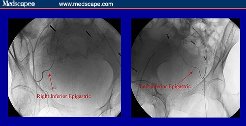 Advances in Imaging: Interventional Perspectives, Case III