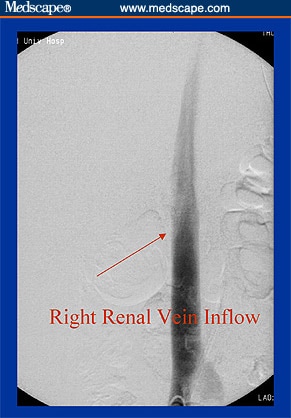 Interventional Perspectives, Case IV: Posttraumatic Evaluation a