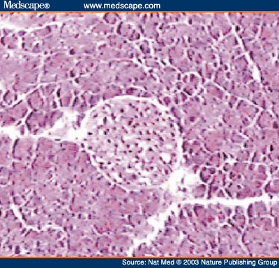 Autoimmune Islet Destruction in Spontaneous Type 1 Diabetes - Page 2