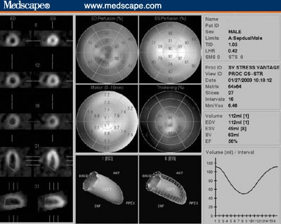 Role of Myocardial Perfusion Imaging in Managing CAD - Page 6