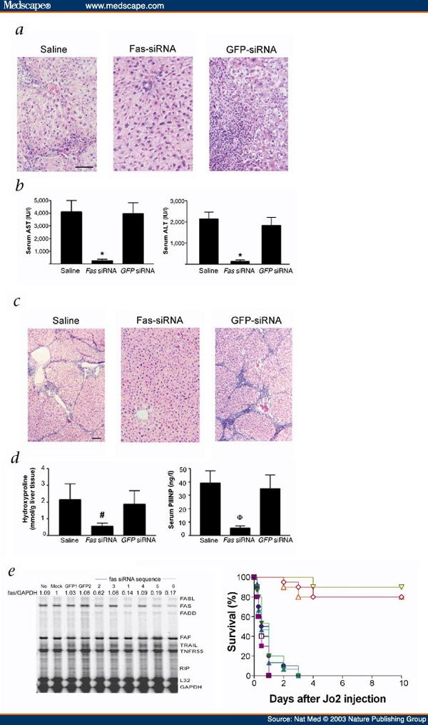 RNA Interference Targeting Fas Protects From Fulminant Hepatitis