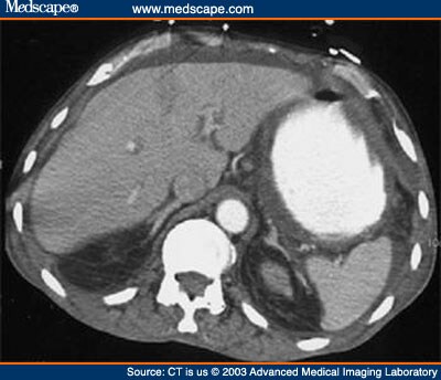 CT Quiz of the Month, March 2003 - Nausea and Vomiting