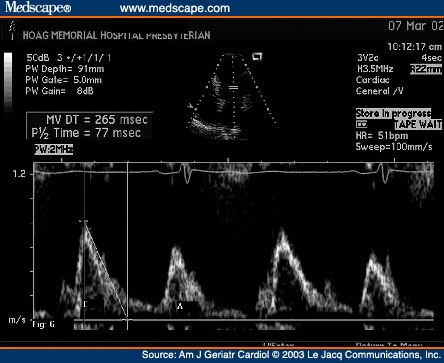 Diagnosis of Aortic Stenosis in the Elderly - Page 8