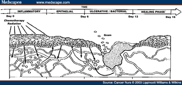 Mechanisms for Radiation-Induced Oral Mucositis - Page 5