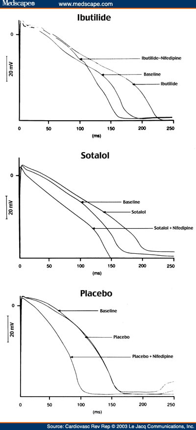 Ibutilide and Calcium Channel Blockers: Is There an Interaction? - Page 3