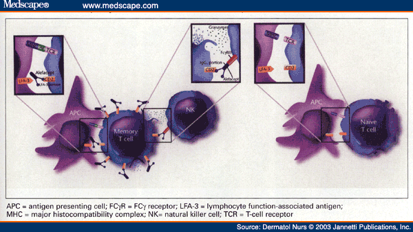 Alefacept for Chronic Plaque Psoriasis: A Selective Therapy - Page 6