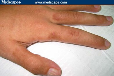 Medical Mission to Honduras - Page 3