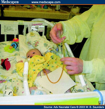 How-To Guide for Gastrostomy Tube Placement in Infants - Page 7