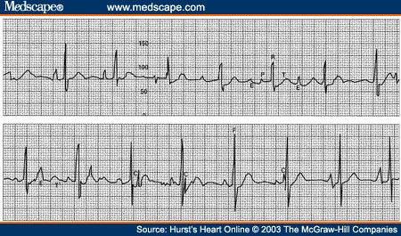 Long-Term Continuous Electrocardiographic Recording - Page 6