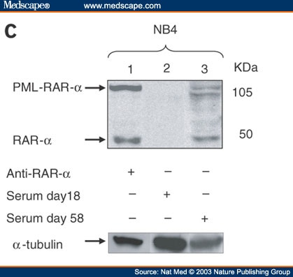 PML-RARA-Targeted DNA Vaccine Induces Protective Immunity
