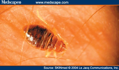 The Bedbugs Never Left