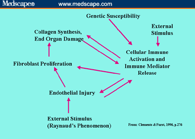 Scleroderma: A Fascinating, Troubling Disease - Page 3